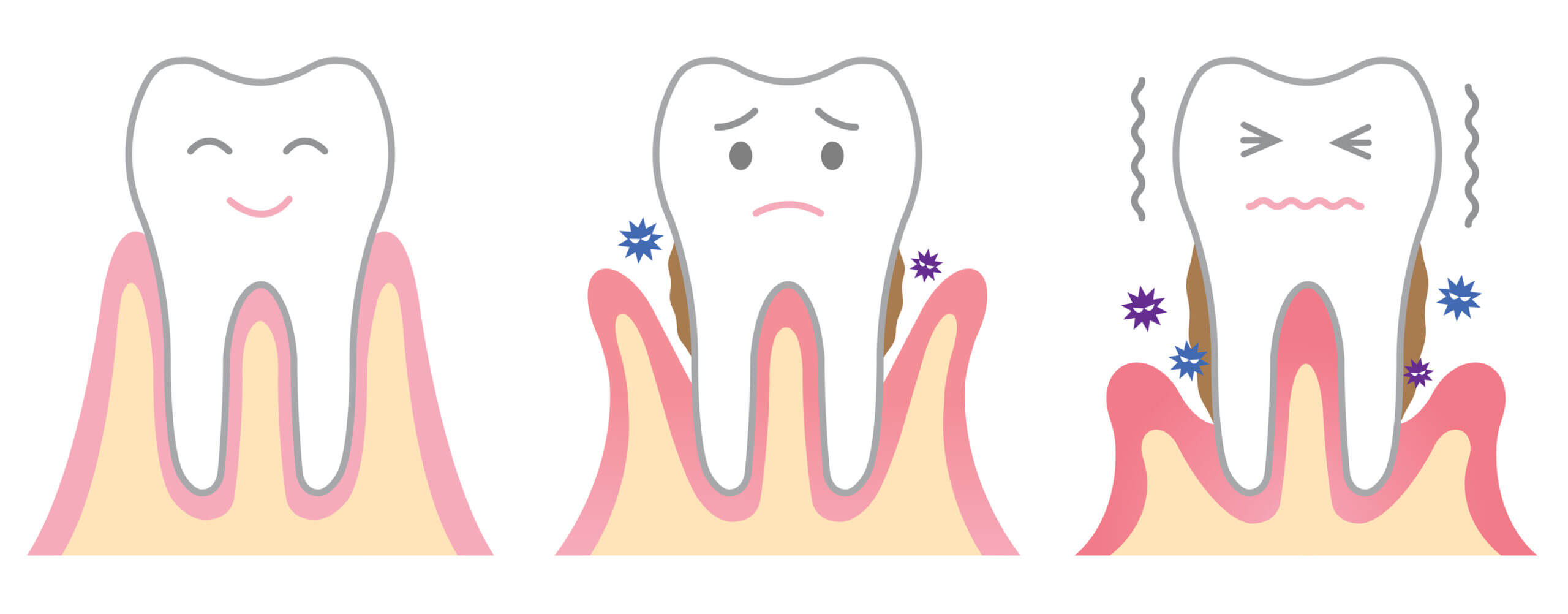What Is Periodontal Disease Anyway? | Brookline Dental Specialists